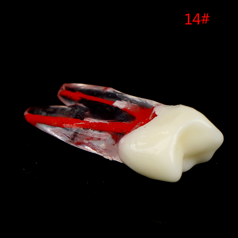 Dental Endodontic Tooth Model With Colored Root Canal And Pulp Model ...