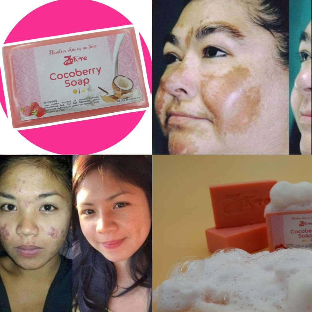 ( Buy 1 Take 1 ) NO NEED DERMA TRENDING NA SABON NA PAMPAKINIS AT PAMPAPUTI IN JUST 1-2 WEEKS ...