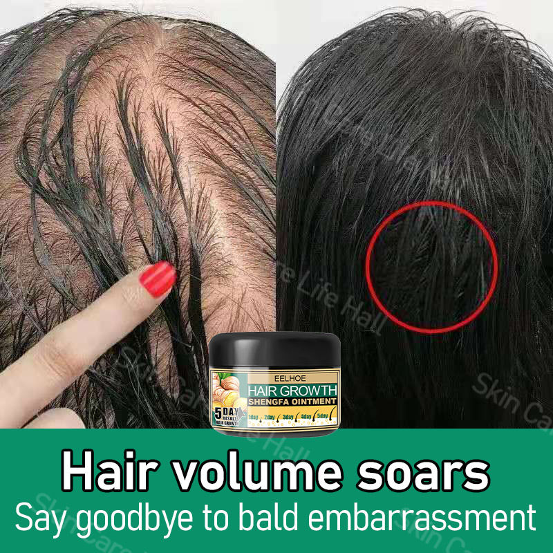 【Support COD】🔥 hair grower hair grower for men original 100% natural ...