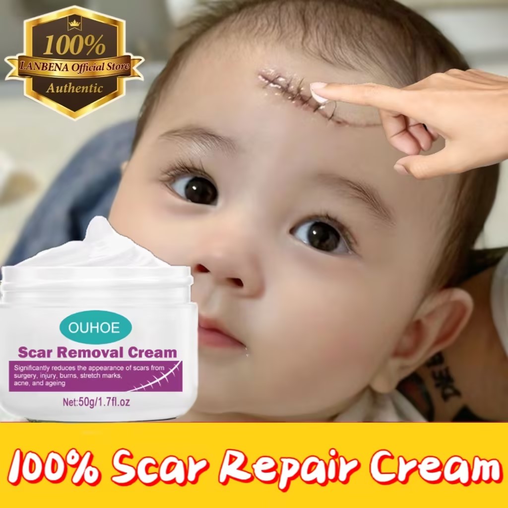 100% Scar Repair Cream for Old Scar on Leg Stretch Mark Remover Acne ...