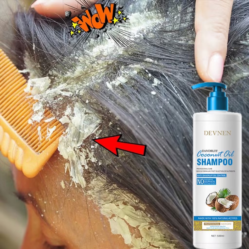 DEVNEN Coconut Oil Shampoo 500ML Anti-Dandruff Repair Damage Relieve ...