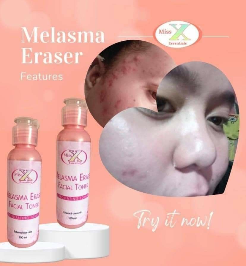 MISS X MELASMA ERASER FACIAL TONER | Lazada PH