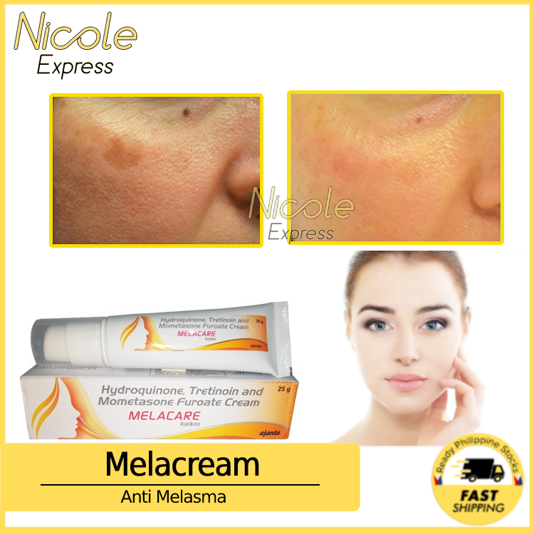 Melacare Cream 25g for Melasma Pekas Remover Pekas Eraser, Skin ...