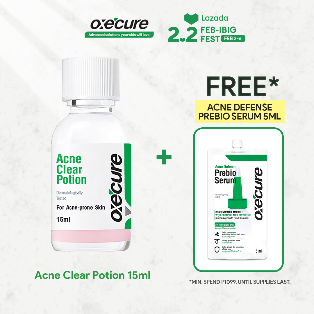 OXECURE ACNE CLEAR POTION 15ml [Pimples, blackheads, whiteheads ...