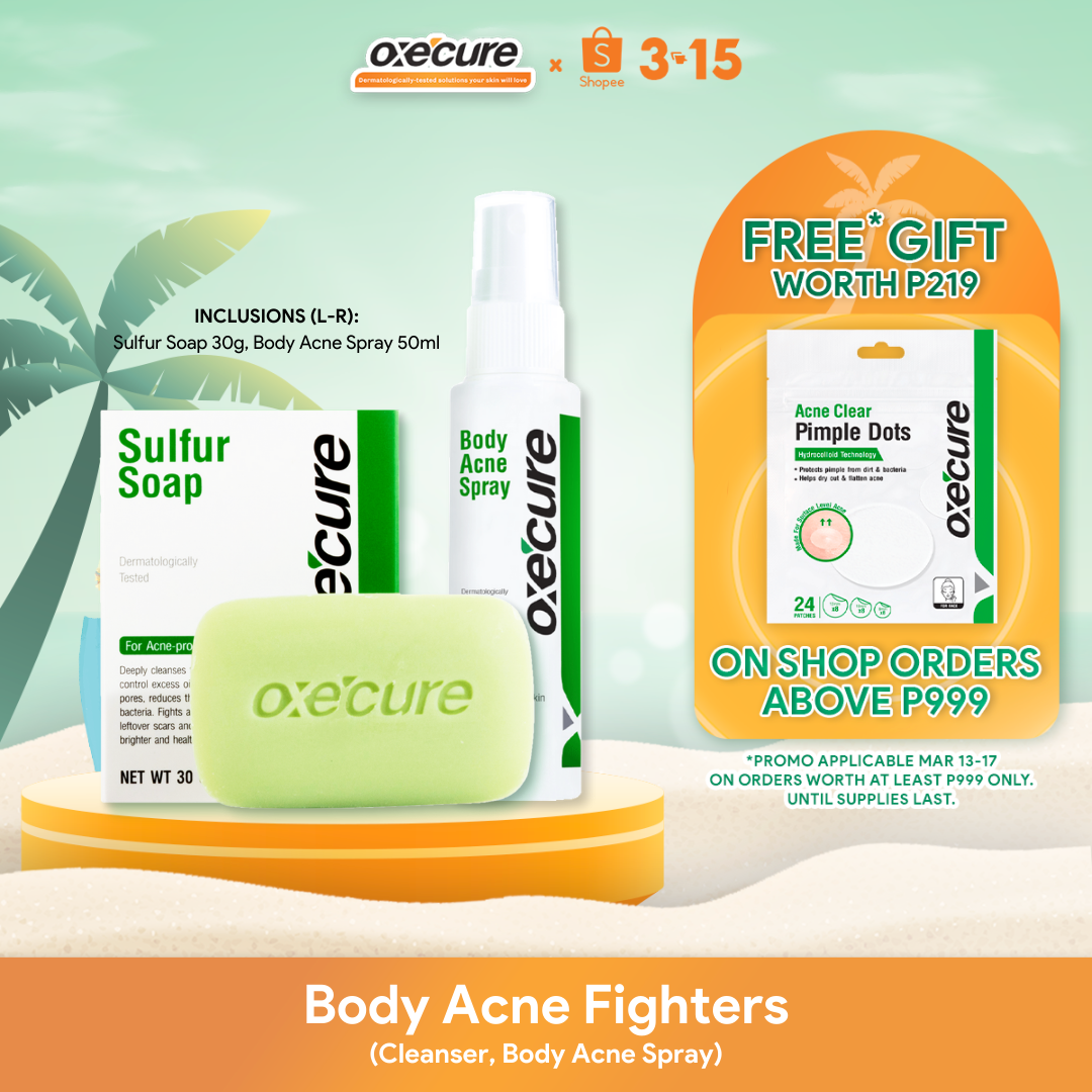OXECURE Alden's Top Picks: Body Acne Fighters (Sulfur Soap 30g, Body ...