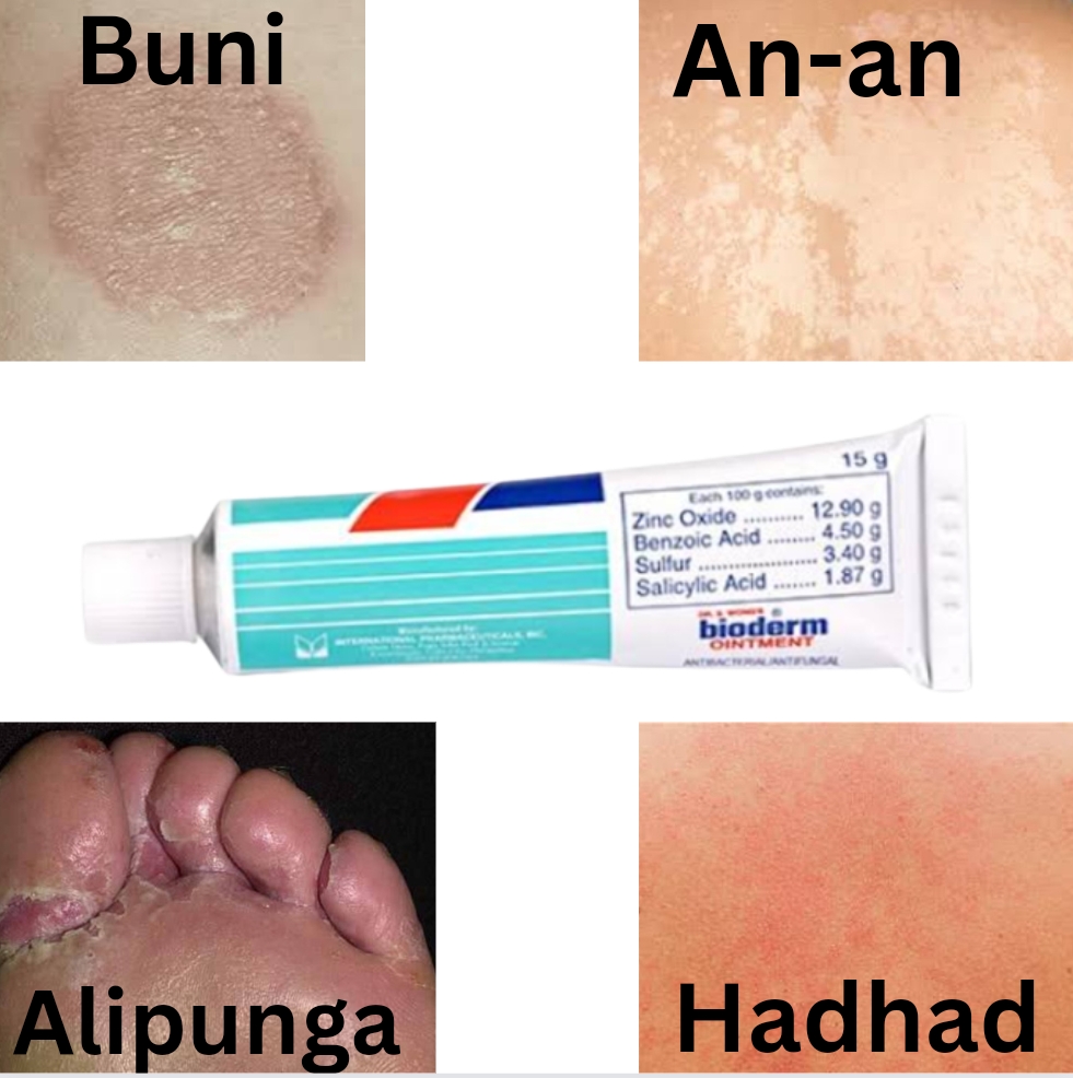 Anti-fungal Cream: Gamot sa An-an, Buni, Hadhad, Alipunga at iba pa 5g ...