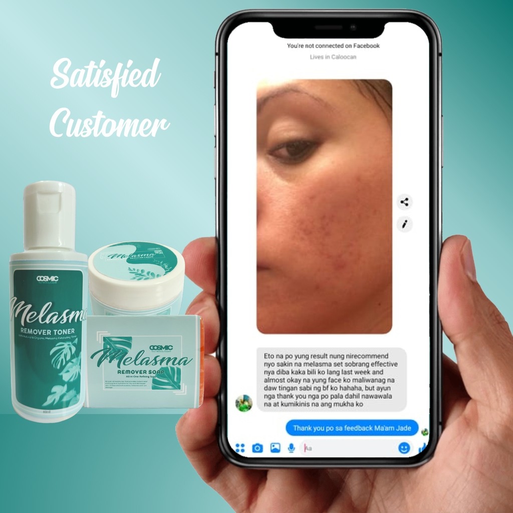 Original COSMICLAB Melasma Remover Soap Premium Pekas Remover | Lazada PH