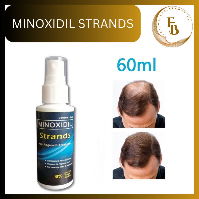 Minoxidil Strands 6% Minoxidil Topical Solution (60ml per bottle) Hair ...