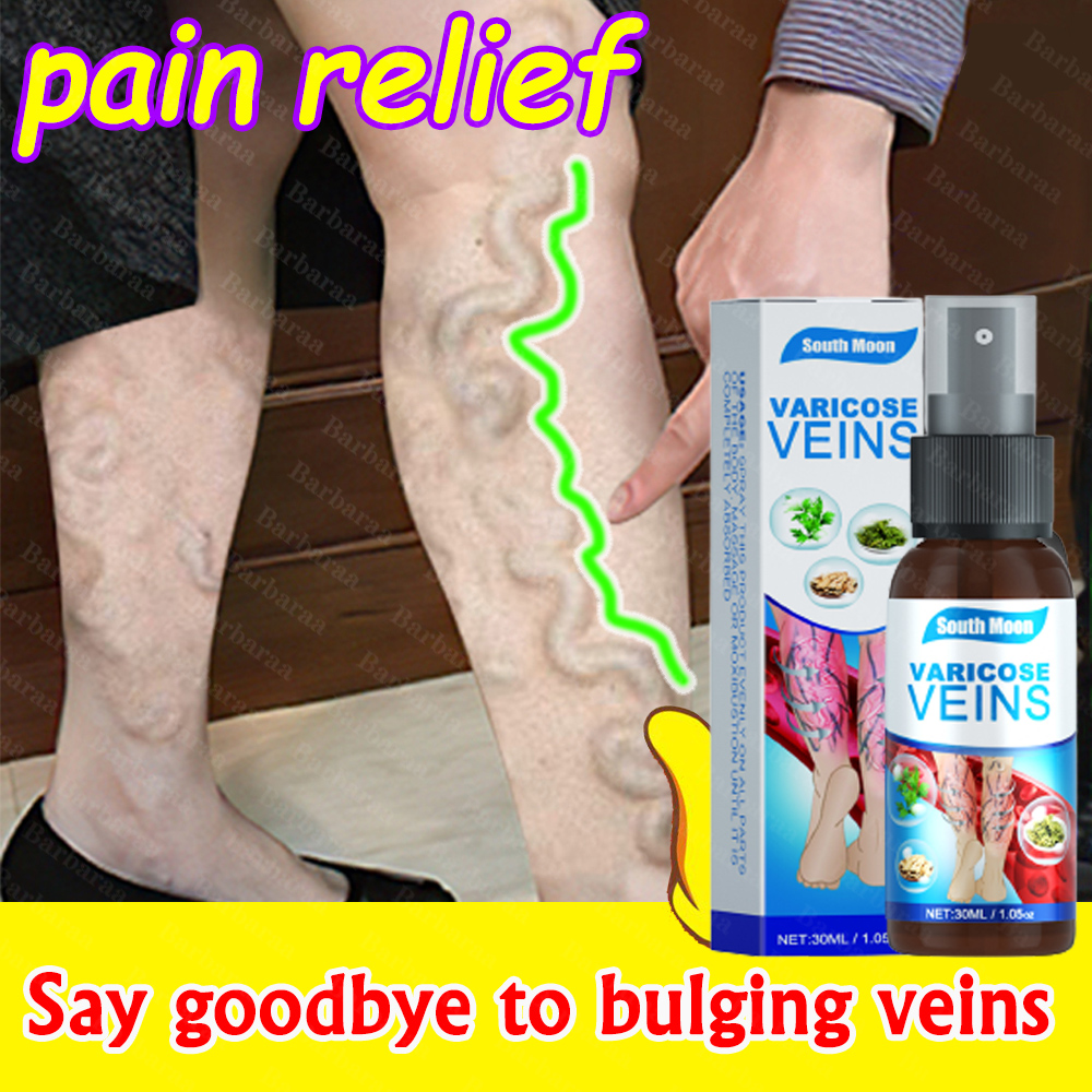 Varicose Veins Remover spray Effective Original Varicose Veins Remover ...