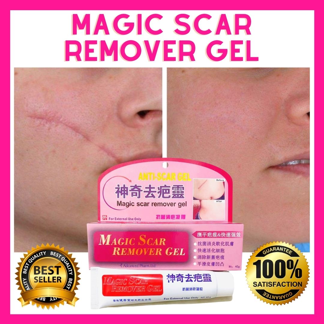 The Trends Shoppe - FLASH SALE! 100% Authentic Magic Scar Remover Gel ...