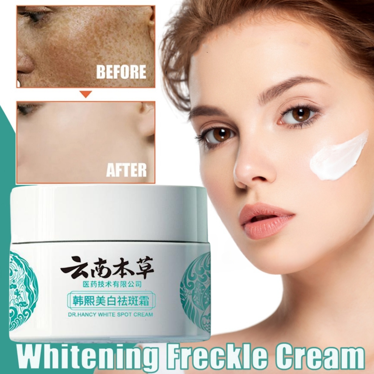 Effective Melasma Cream Pekas Remover Facial Cream Remove Dark Spots ...