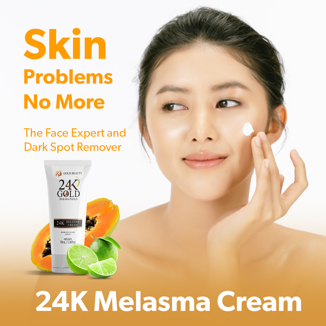 24K Melasma Cream by K Gold Beauty- Melasma and Pekas Remover, Keloids ...