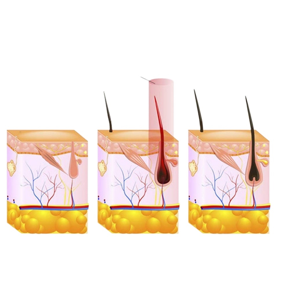 COD Pampatubo ng Balbas Authentic Beard Growth Grower Hair Mustache ...