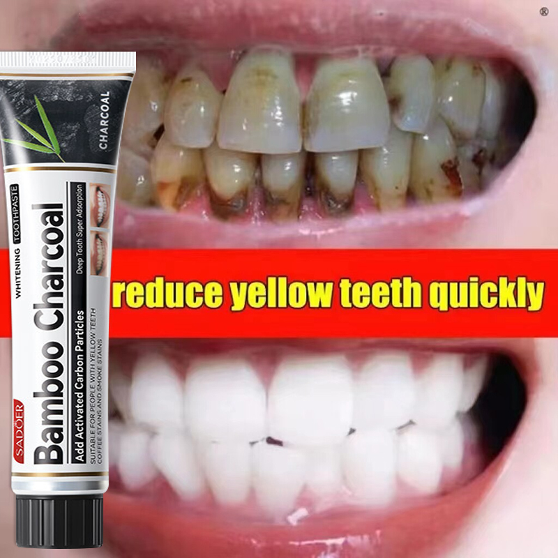 Teeth Whitening Toothpaste 100g Bawboo Charcoal Teeth Whitening Black ...