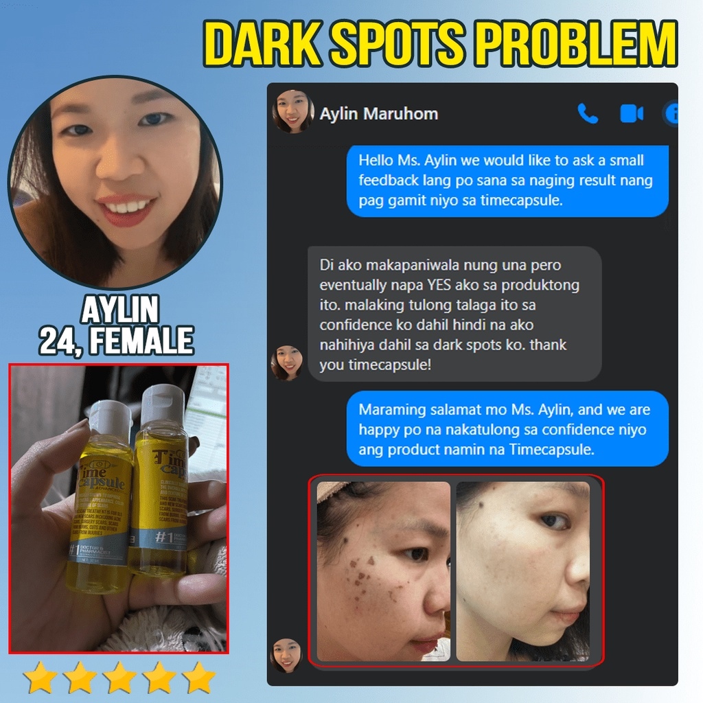 Timecapsule Original Scars Peklat Melasma Pekas Keloids Acne Blackhead ...
