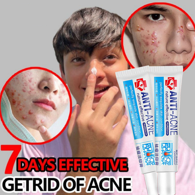Effective Quickly Remove Pimples Remover Acne Cream Fades Acne Marks Repairs Acne Pits Facial ...