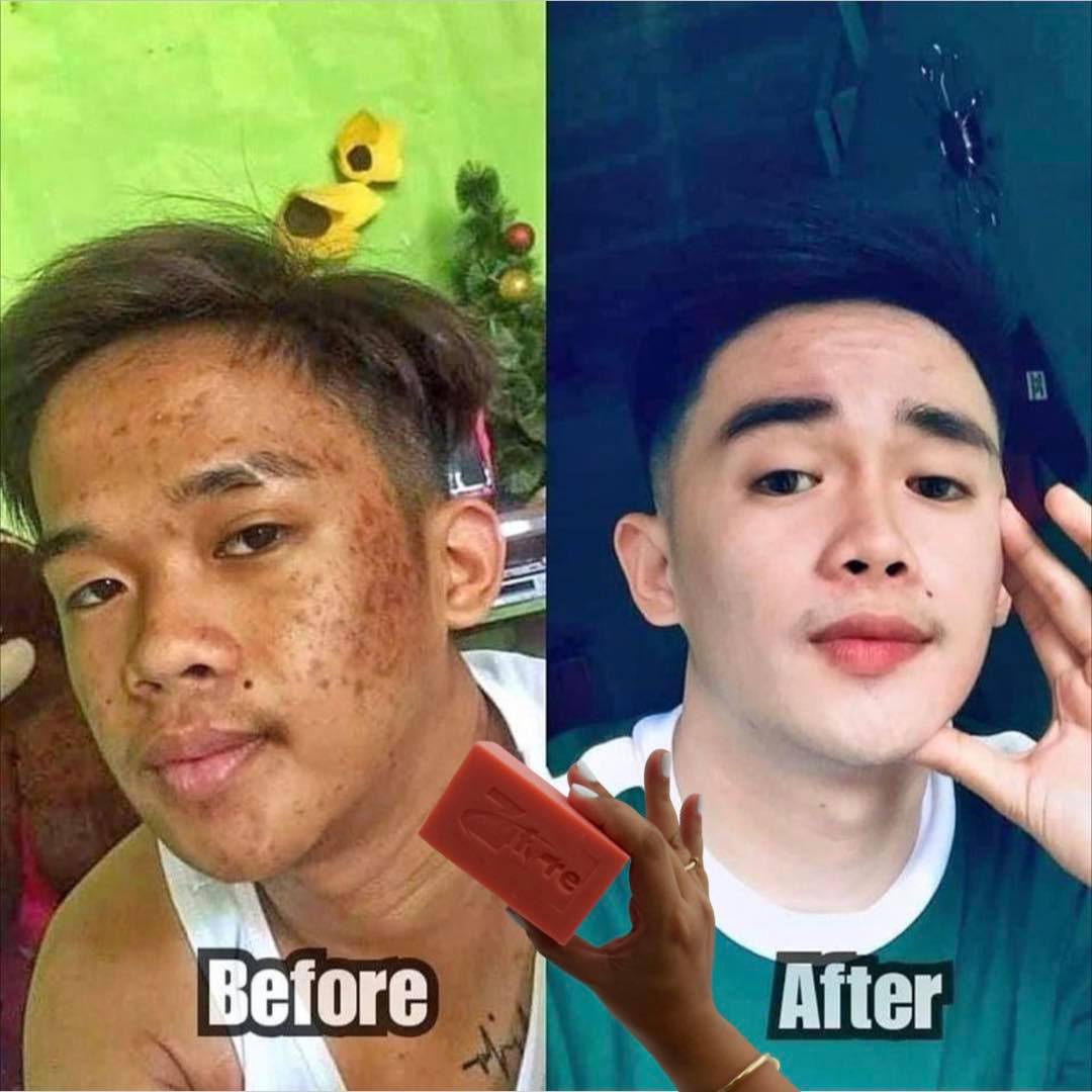 TRENDING NA SABON NA PAMPAKINIS AT PAMPAPUTI IN JUST 1-2 WEEKS LANG!ZAFYRE COCOBERRY SOAP | SKIN ...