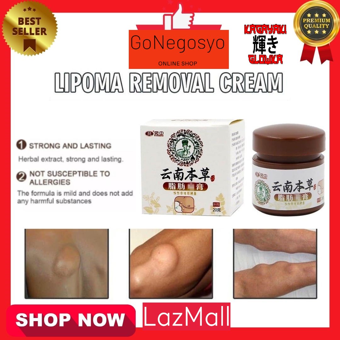 Lipoma | Removal | Herbal Ointment | Tumor Treatment | Multiple Anti ...