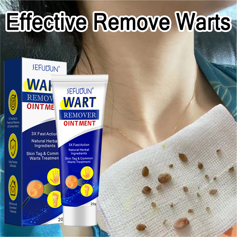 COD Hot Sale Warts Remover Original Cream Warts Magic Remover Wart ...