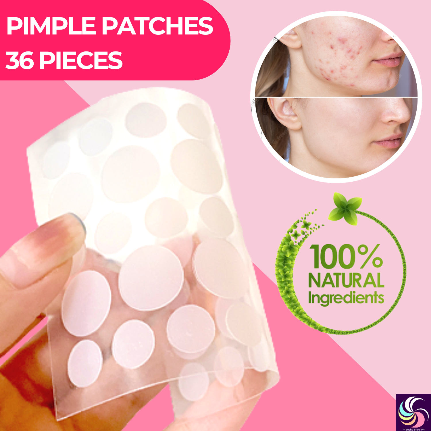 BREATHE 36pcs/Box | Waterproof Acne Pimple Patch | For children to ...