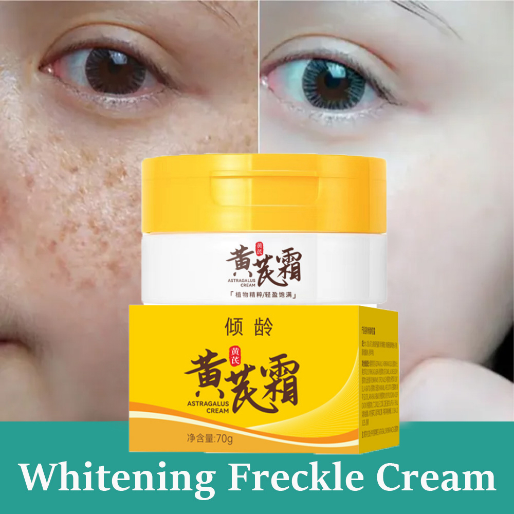 Original Melasma Remover Cream Astragalus Herbal Whitening Freckle ...