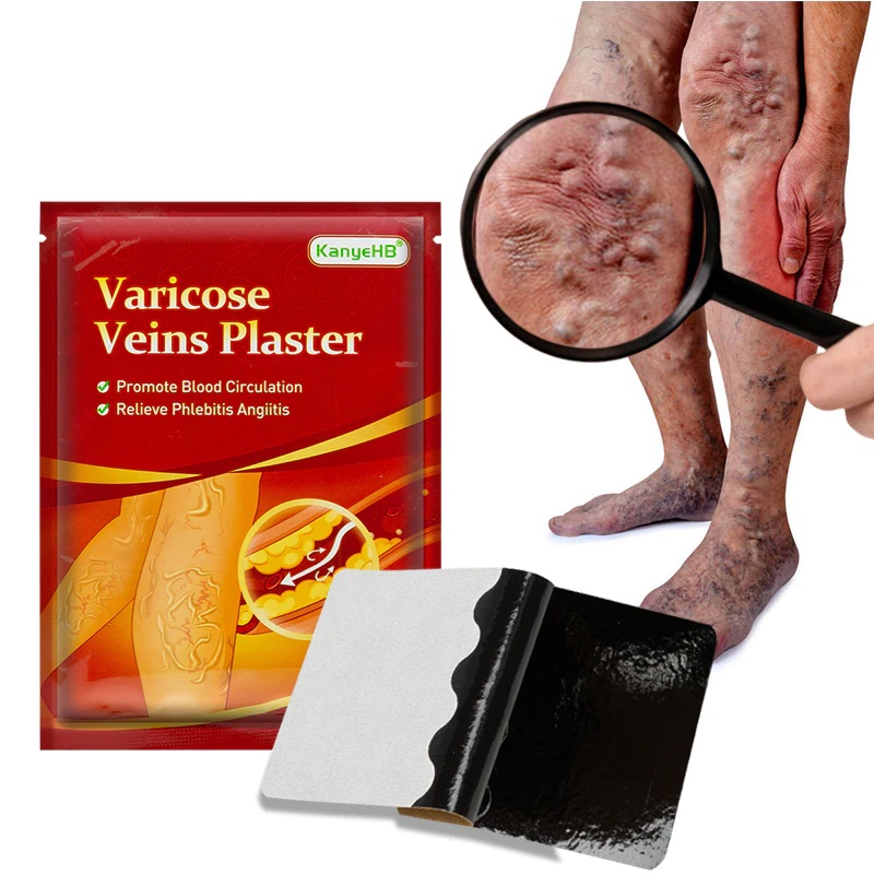 6pcs/bags Varicose Veins Plaster Traditional Medicine Vasculitis ...