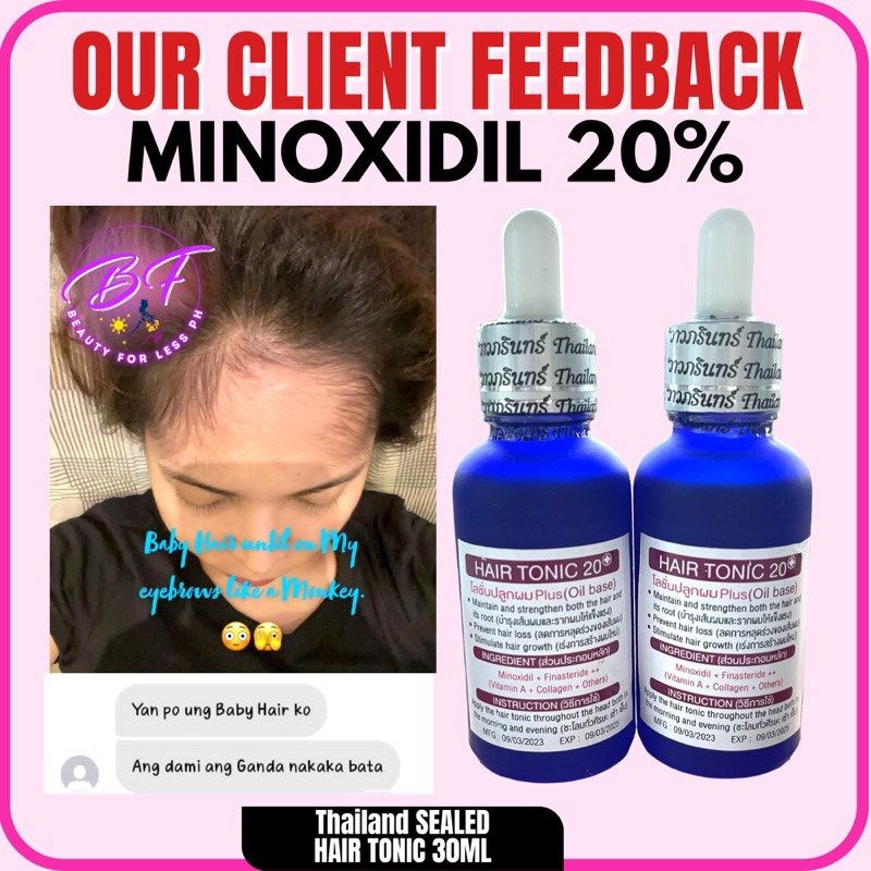 BEWARE OF FAKE! WITH SEAL! Minoxidil 20 HAIR TONIC BEST SELLING Authentic Made in Thailand 【COD ...