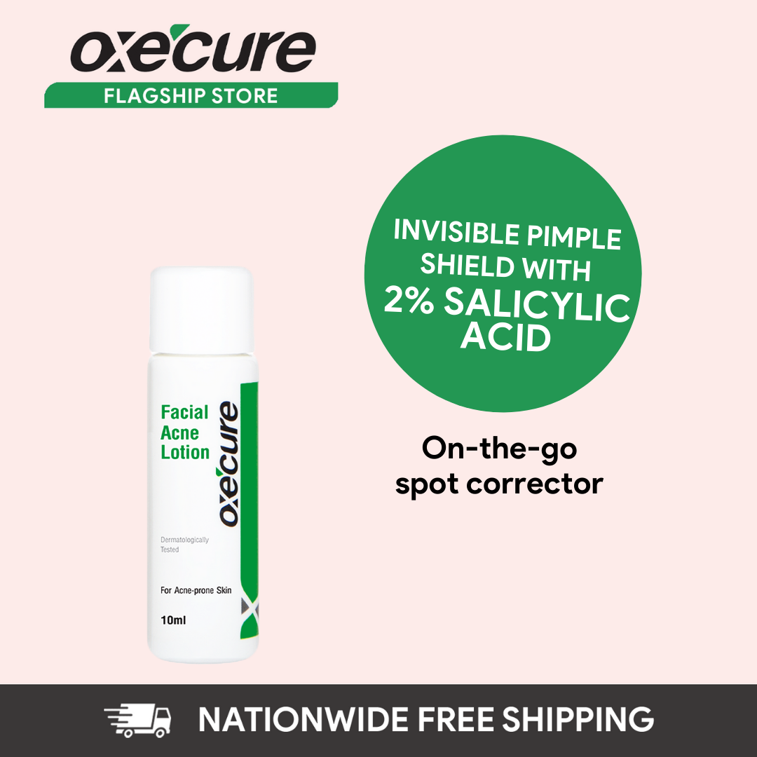 Oxecure Facial Acne Lotion 10mL [Pimples, blackheads, whiteheads ...