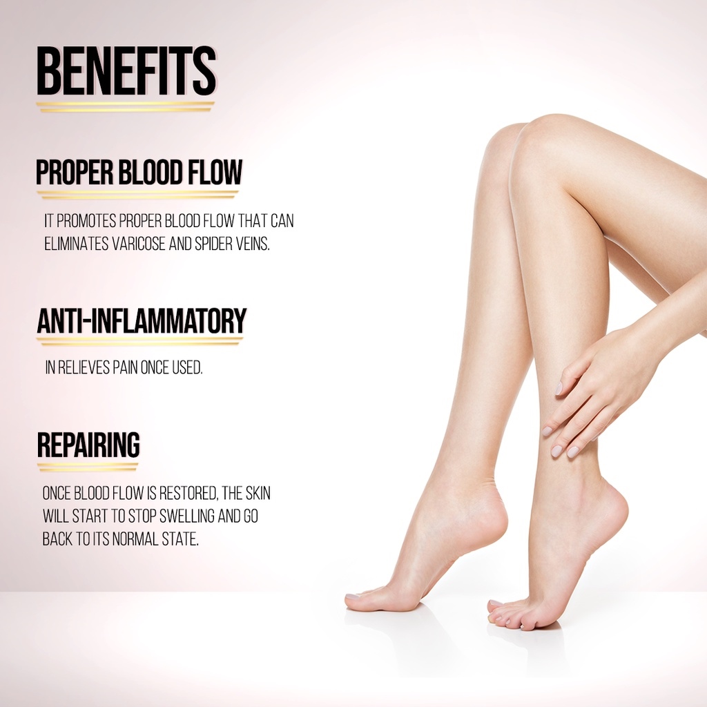 Hisoo Vari-Move! 15ml Varicose Veins and Spider Veins Treatment Serum ...