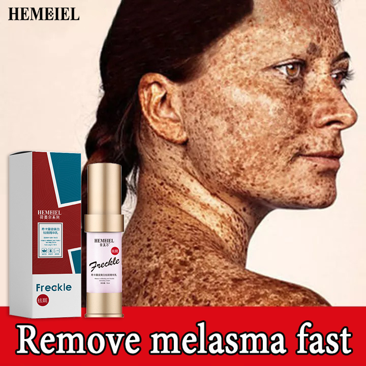 HEMEIEL Whitening Cream / Olee White Clean Melasma and Freckles / Dr ...