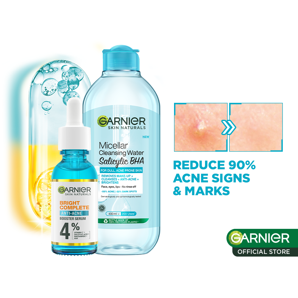 NEW Garnier Bright Complete Anti Acne Starter Duo: Anti Acne Serum and ...