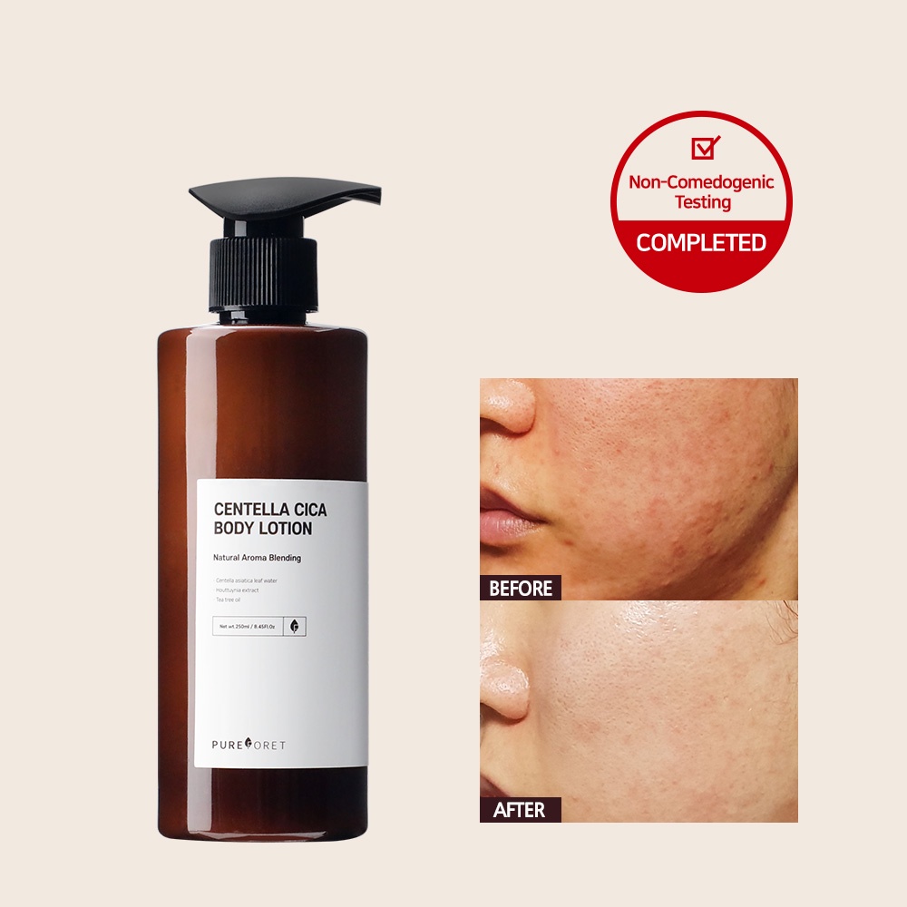 Pureforet Cenla Cica Body Lotion 250ml Acne Pimple Sensitive Scar Cica ...