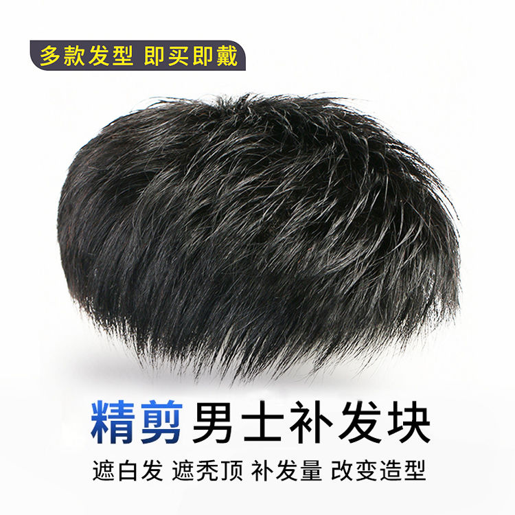 Lalaki na may mga paruka, maikling buhok, mga patch ng buhok sa tuktok ...