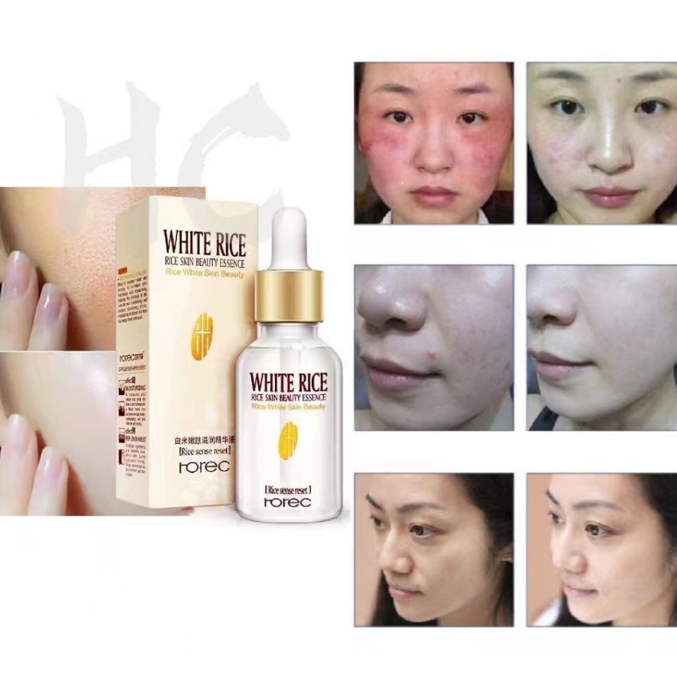 ROREC White Rice Serum Reduces Wrinkles Dark Spots essence moisturizing ...