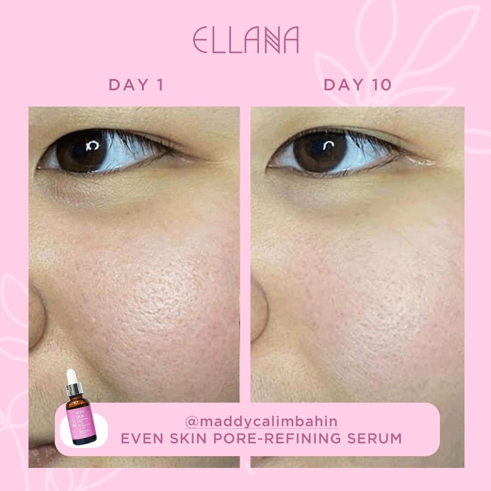 ELLANA Even Skin Pore Refining Serum (New) with 7 Niacinamide and 1 ...