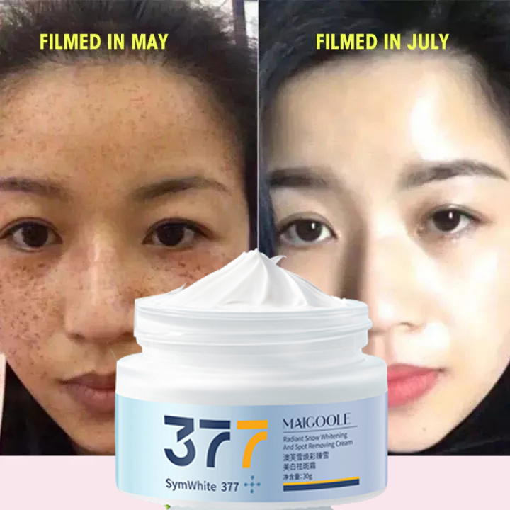 Original 377 Whitening Melasma Cream 30g Japanese Freckle Cream Yunnan ...