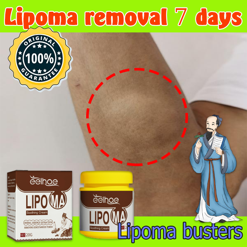 Lipoma Removal Cream Removing Subcutaneous Lipoma Lump Bulge Lipolysis ...