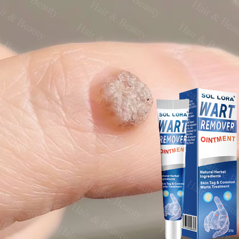 Original Wart Removal Cream Painless wart remover cream Mole remover ...