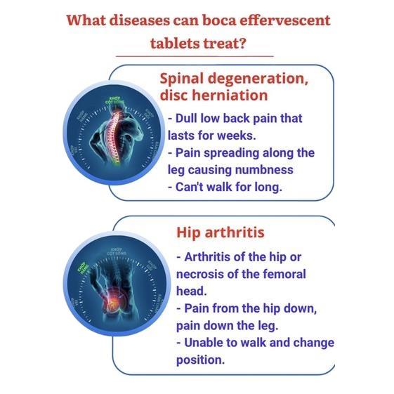 COD BOCA effervescent tablets - Reduce osteoarthritis pain cervical ...