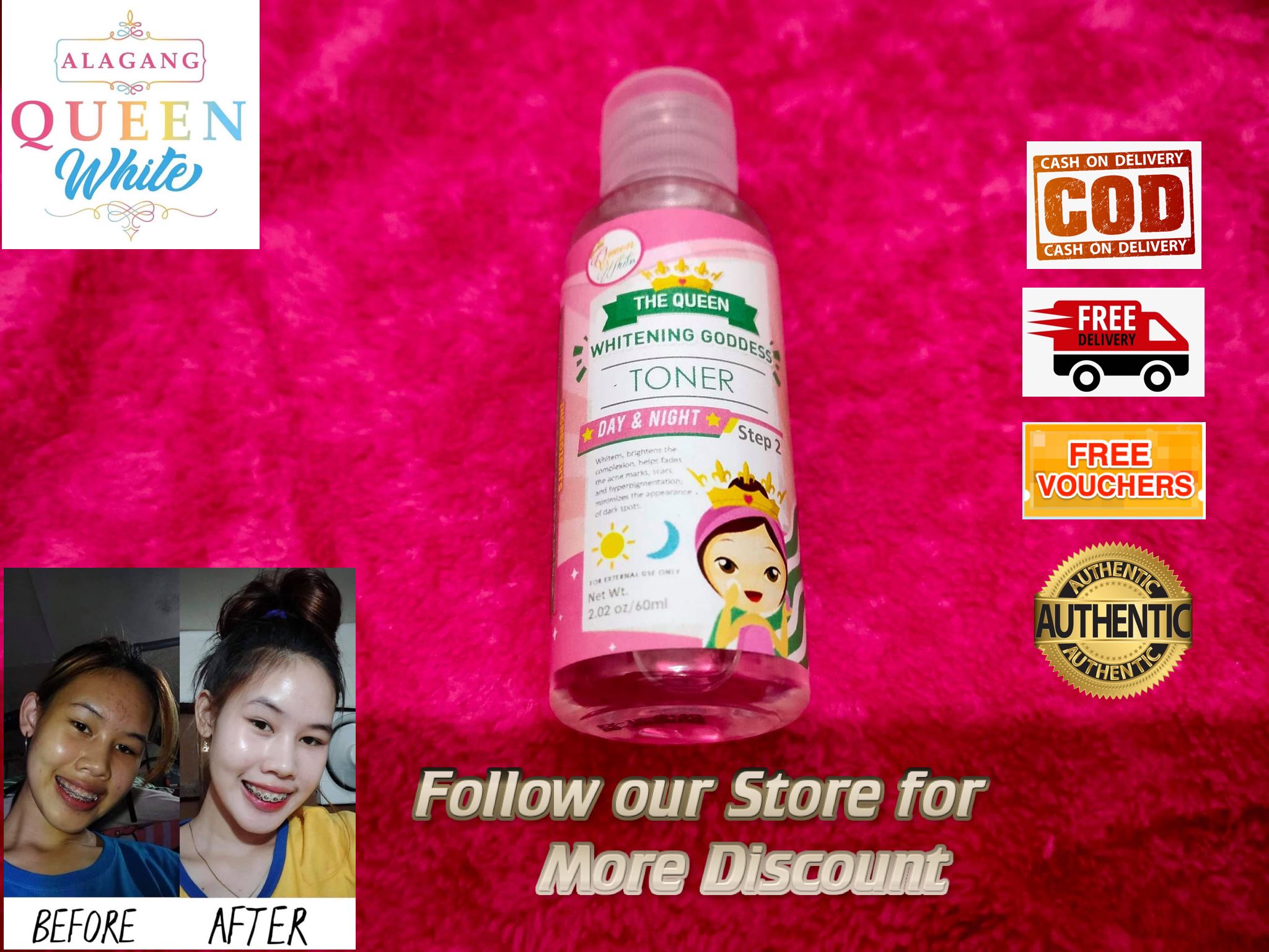 Queen White Whitening Goddess Toner - Authentic (Glass Skin, Anti Acne ...