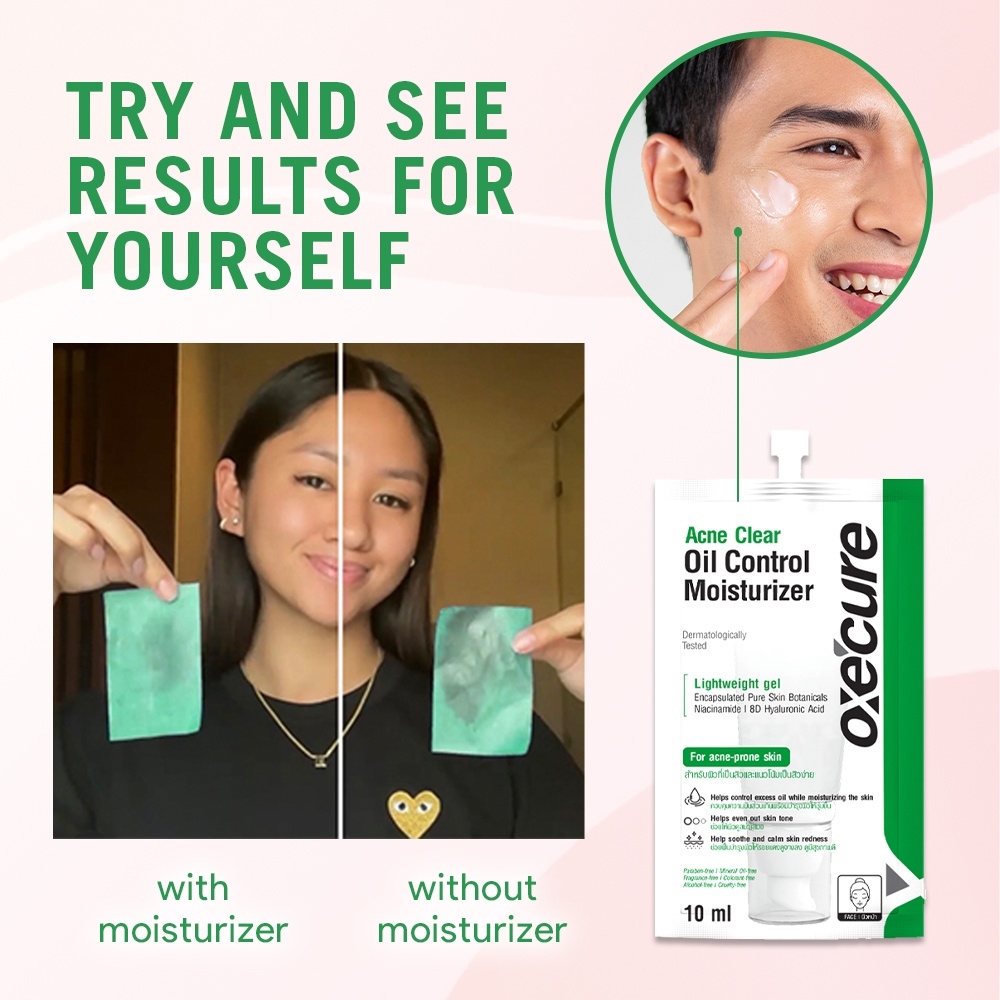 Oxecure Acne Clear Oil Control Moisturizer 75ml | Lazada PH