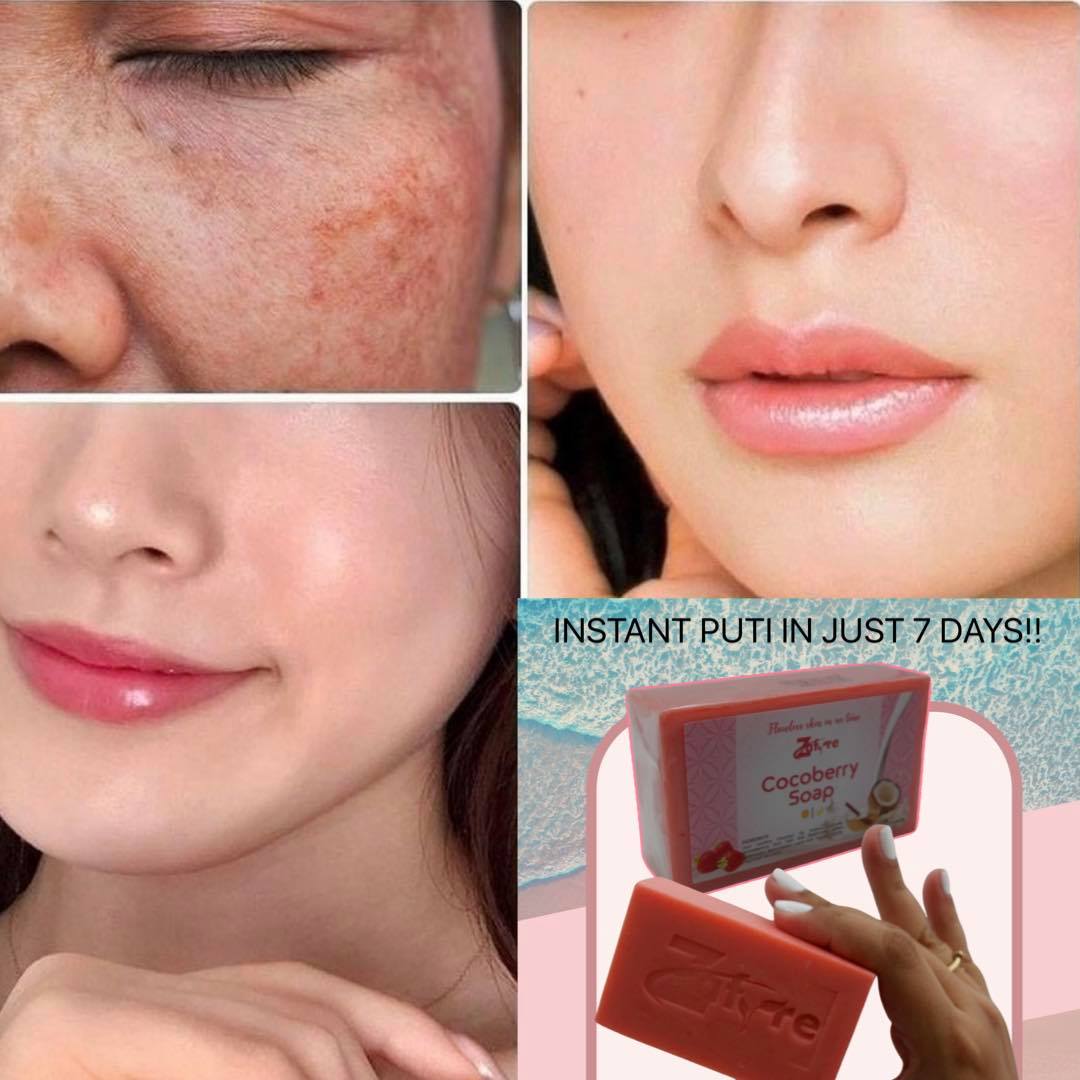 NO NEED DERMA TRENDING NA SABON NA PAMPAKINIS AT PAMPAPUTI IN JUST 1-2 WEEKS LANG! ZAFYRE ...