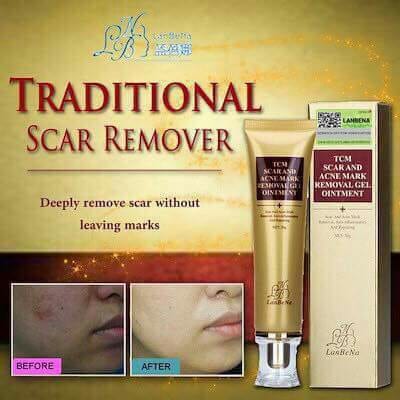ORIGINAL TCM Scar Removal Cream Acne Treatment Skin Repair for Face Ear ...