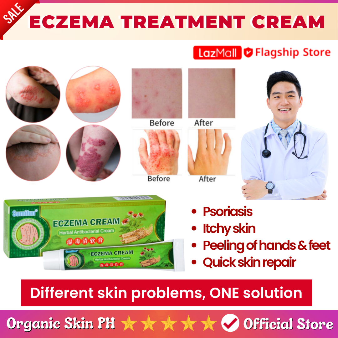 Eczema treatment cream solve skin problems like dermatitis, ringworm ...