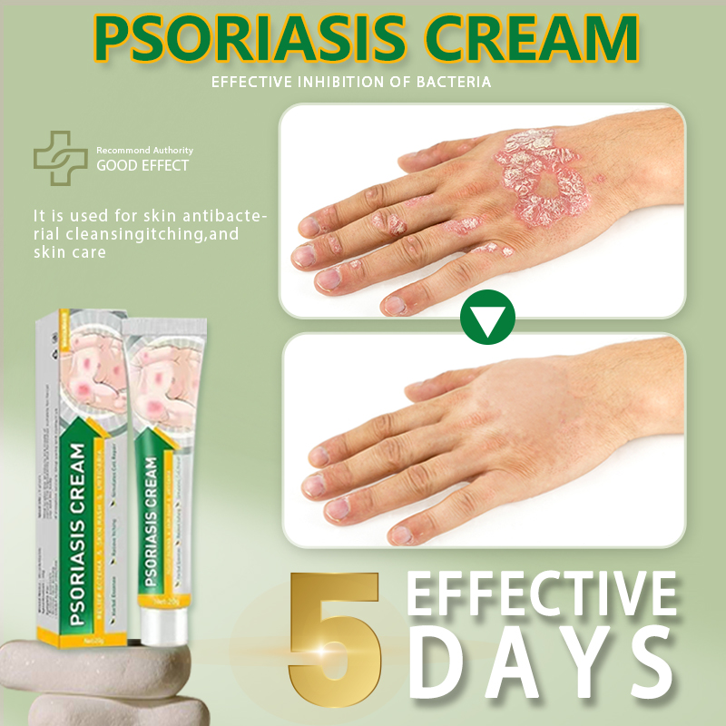 atoderma cream original ointment for itchy skin and allergy gamot sa ...