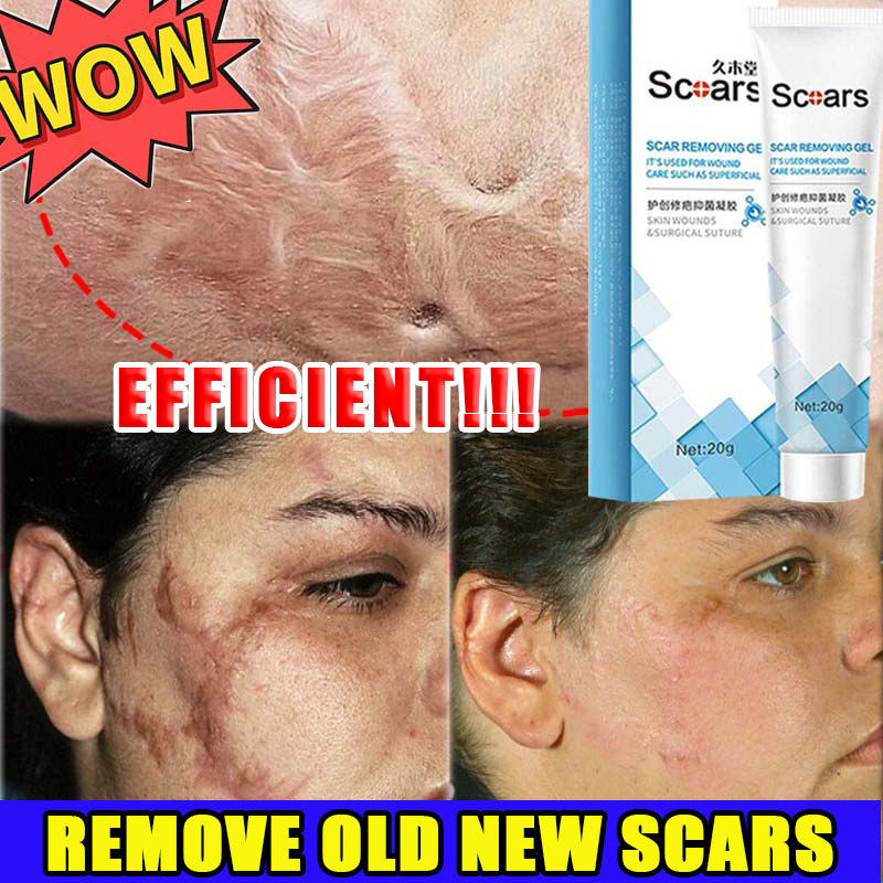 Scar removal cream Effective Miracle Scar Removal Gel Effective scar ...