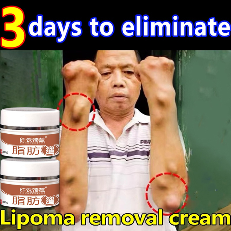 Effective removal in 3 daysQIANXUANZHENCAO Lipoma Removal Cream ...