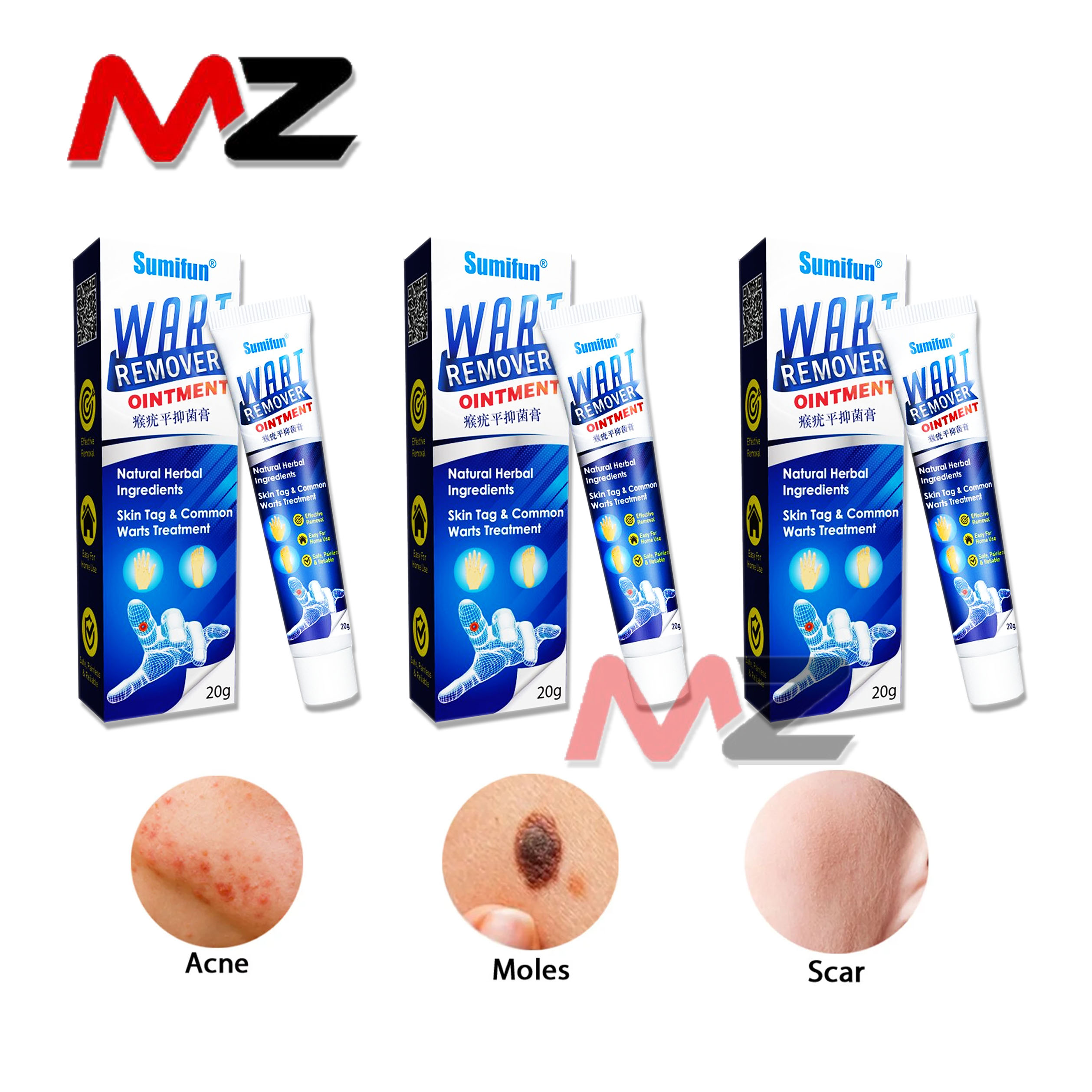 MZ wise ( SET OF 3 ) Sumifun Wart Remover Ointment Wart Treatment Cream ...