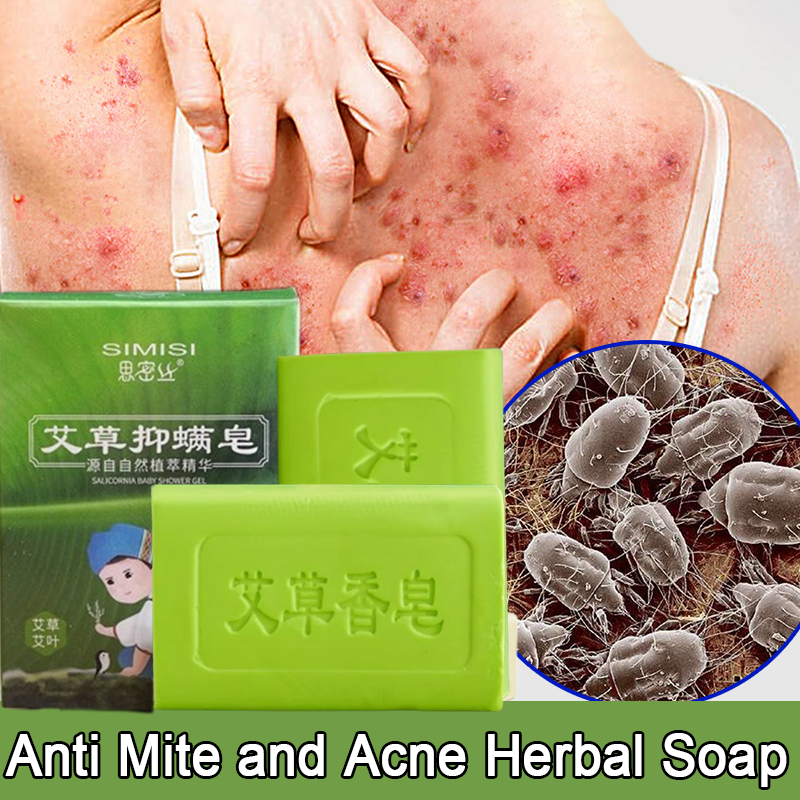 Herbal Anti Itching Mite Removal Soap Whitening Soap Removal Pimple ...