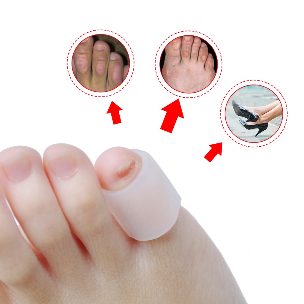 2pcs Transparent Gel Hammer Toe Protection Device German Style Open ...